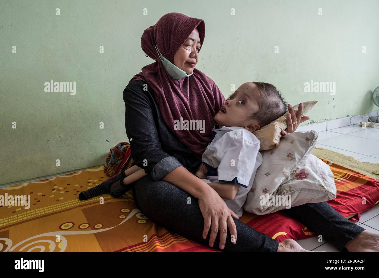 Hydrocephalus childhood hi-res stock photography and images - Alamy