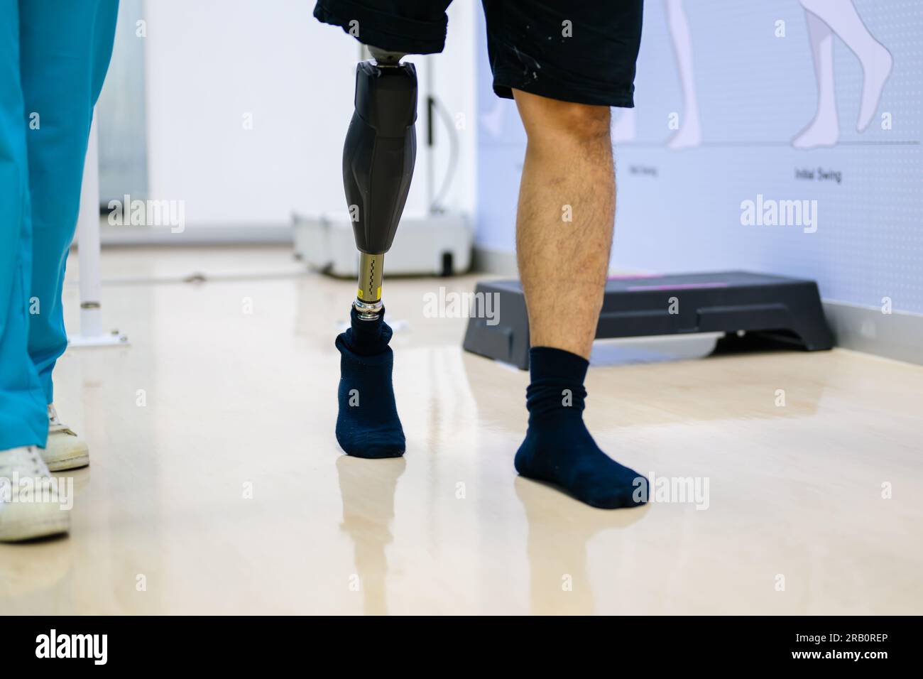 Physiotherapist helping patient with prosthetic leg at parallel bars ...