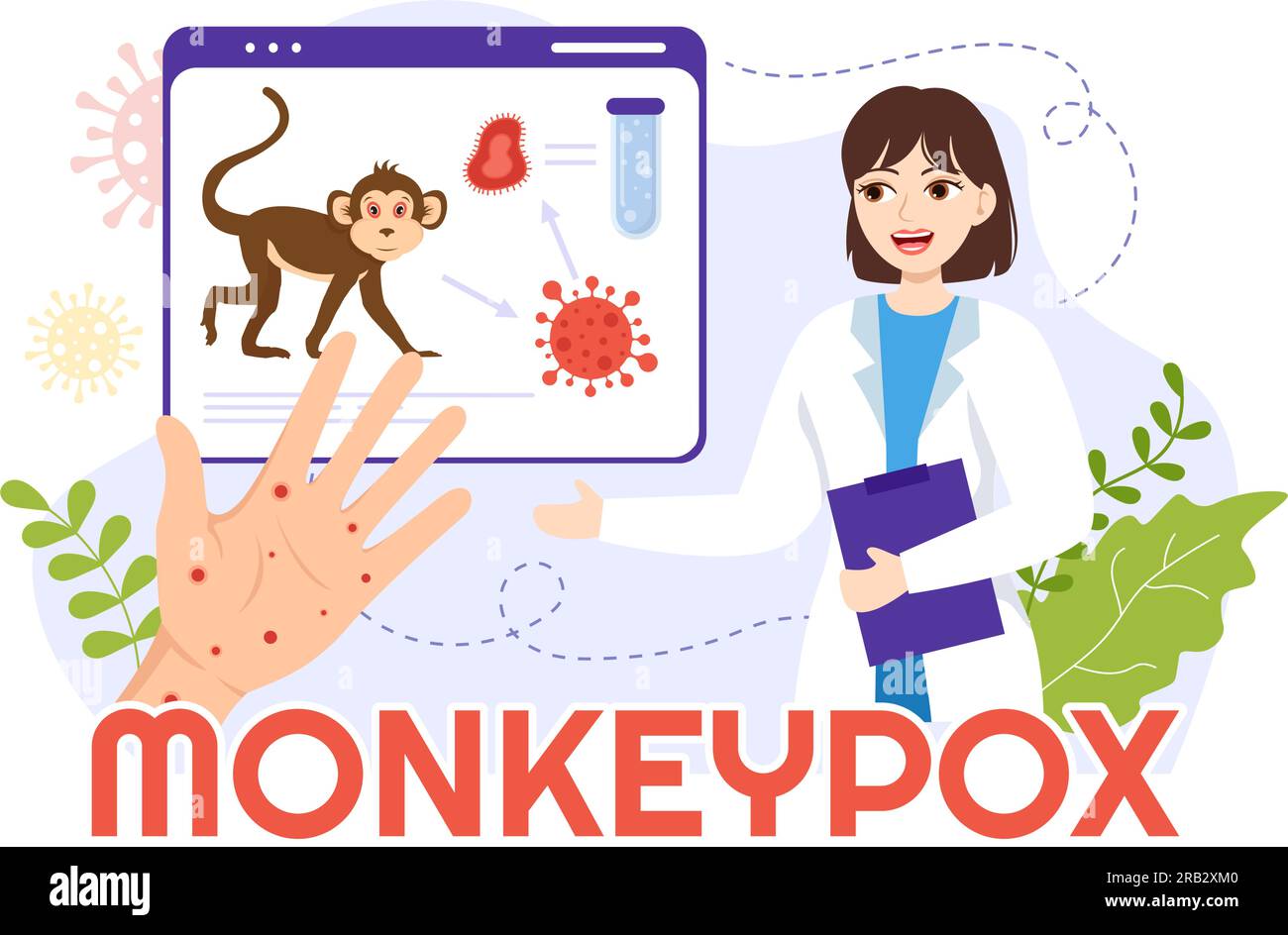 Monkey Pox Outbreak Vector Illustration of Virus Symptoms in Humans ...