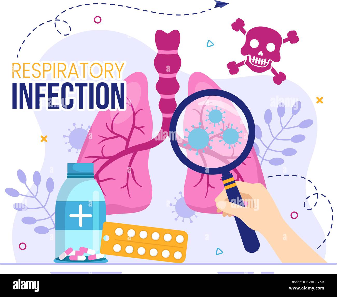 Respiratory Infection Vector Illustration of Inflammation in the Lungs ...