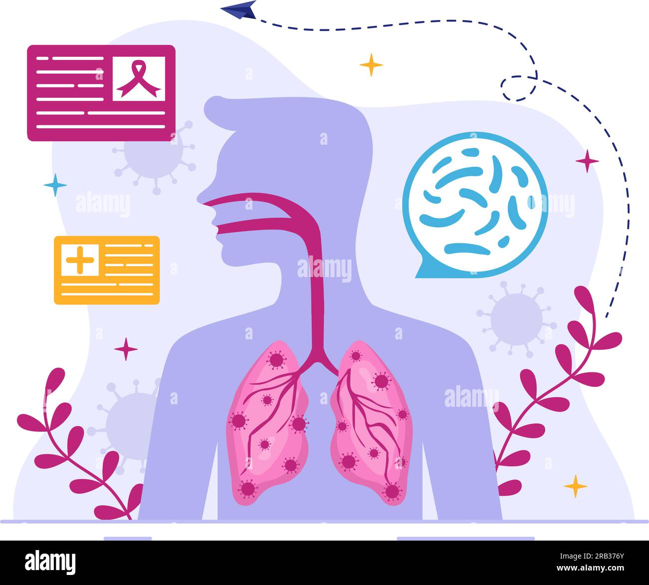Respiratory Infection Vector Illustration of Inflammation in the Lungs ...