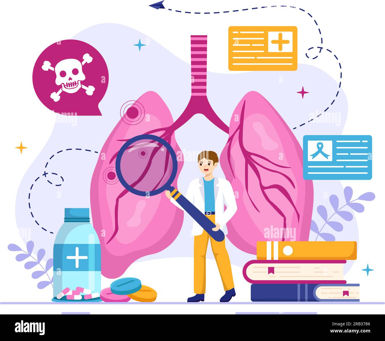 Respiratory Infection Vector Illustration of Inflammation in the Lungs ...