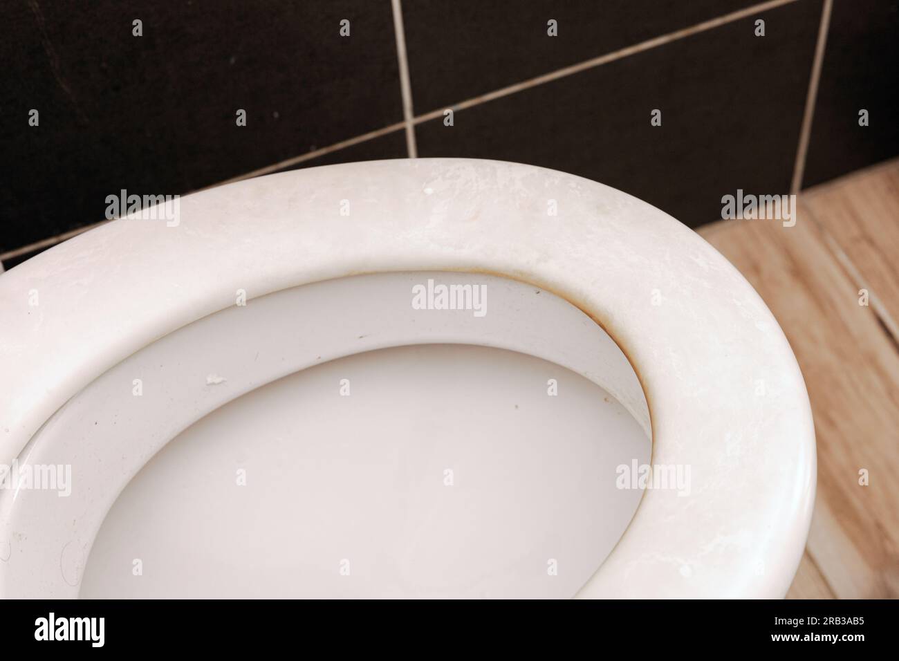 Dirty and disgusting toliet lid, close up view. A lot of bacteria ...