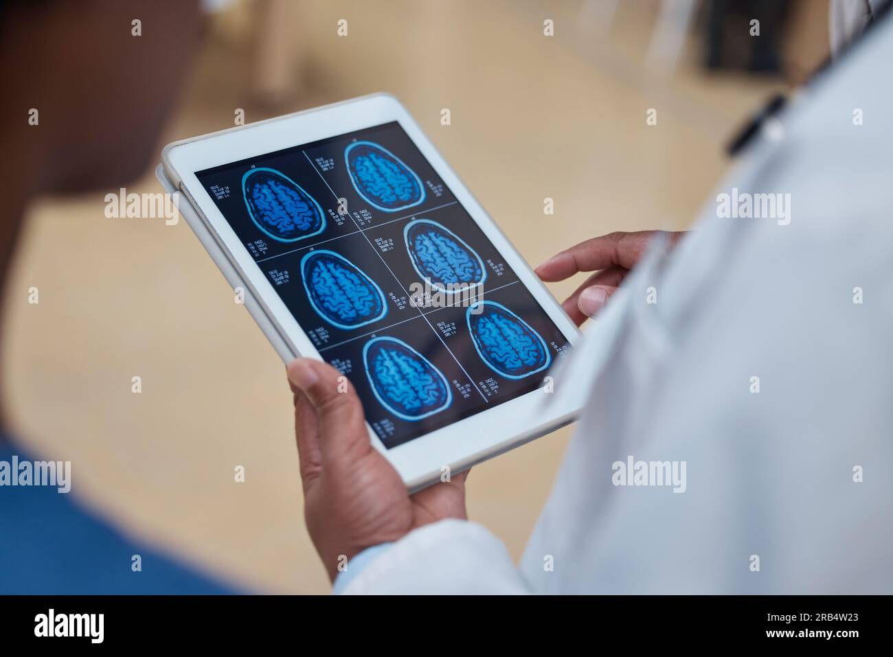 Doctor, hands and tablet with brain scan in healthcare examination ...