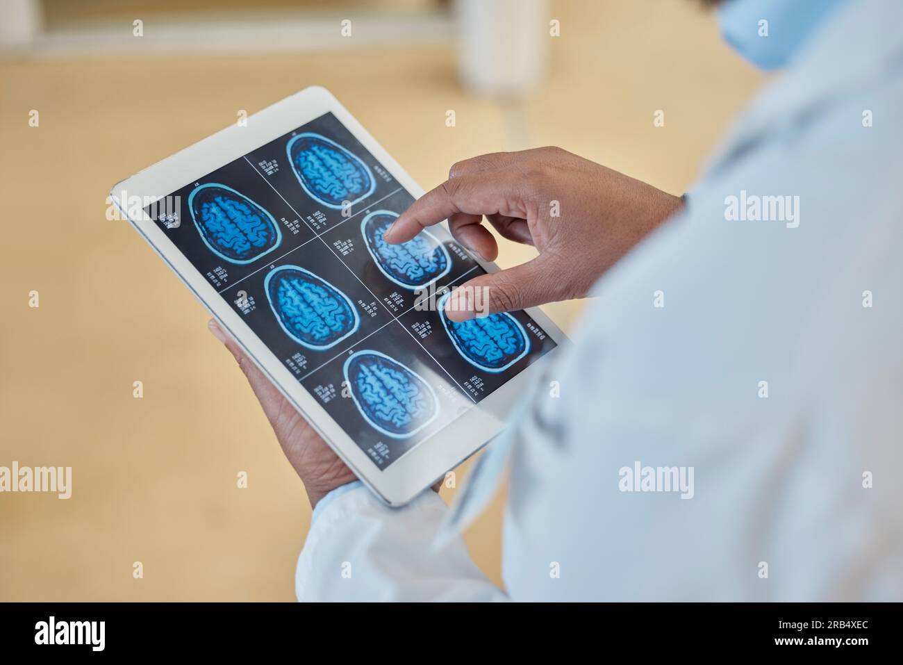 Brain scan, xray and closeup of a doctor with a tablet for a neurology ...