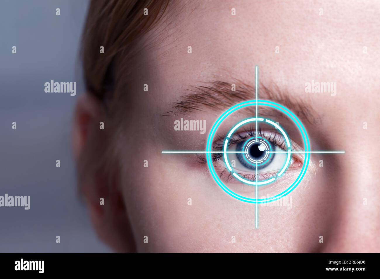 Eye jaundice hi-res stock photography and images - Alamy