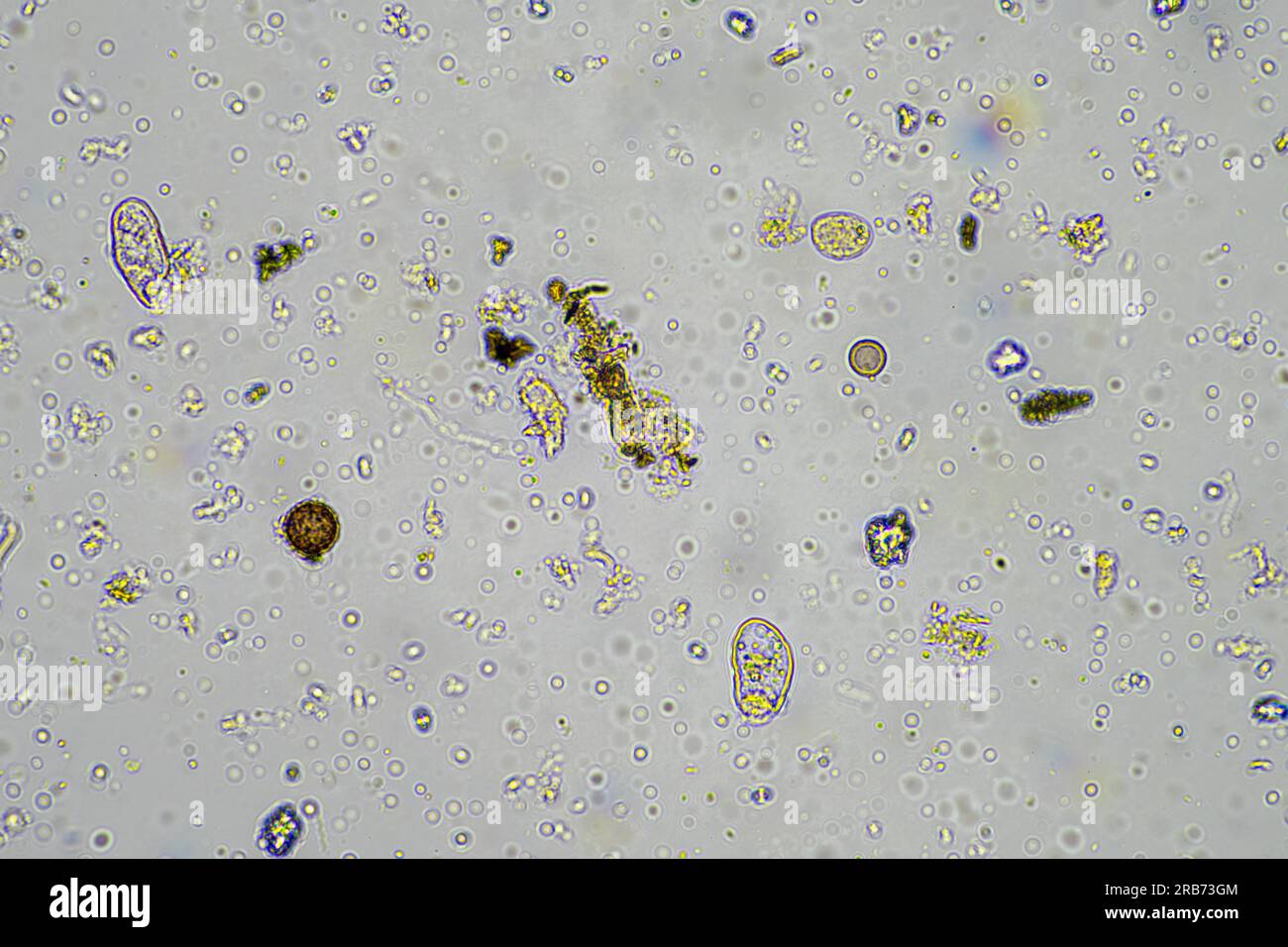 soil sample containing soil biology, with bacteria, fungi, amoeba ...