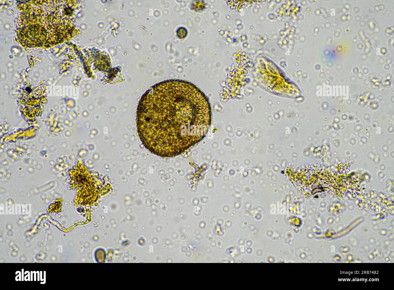 soil sample containing soil biology, with bacteria, fungi, amoeba ...