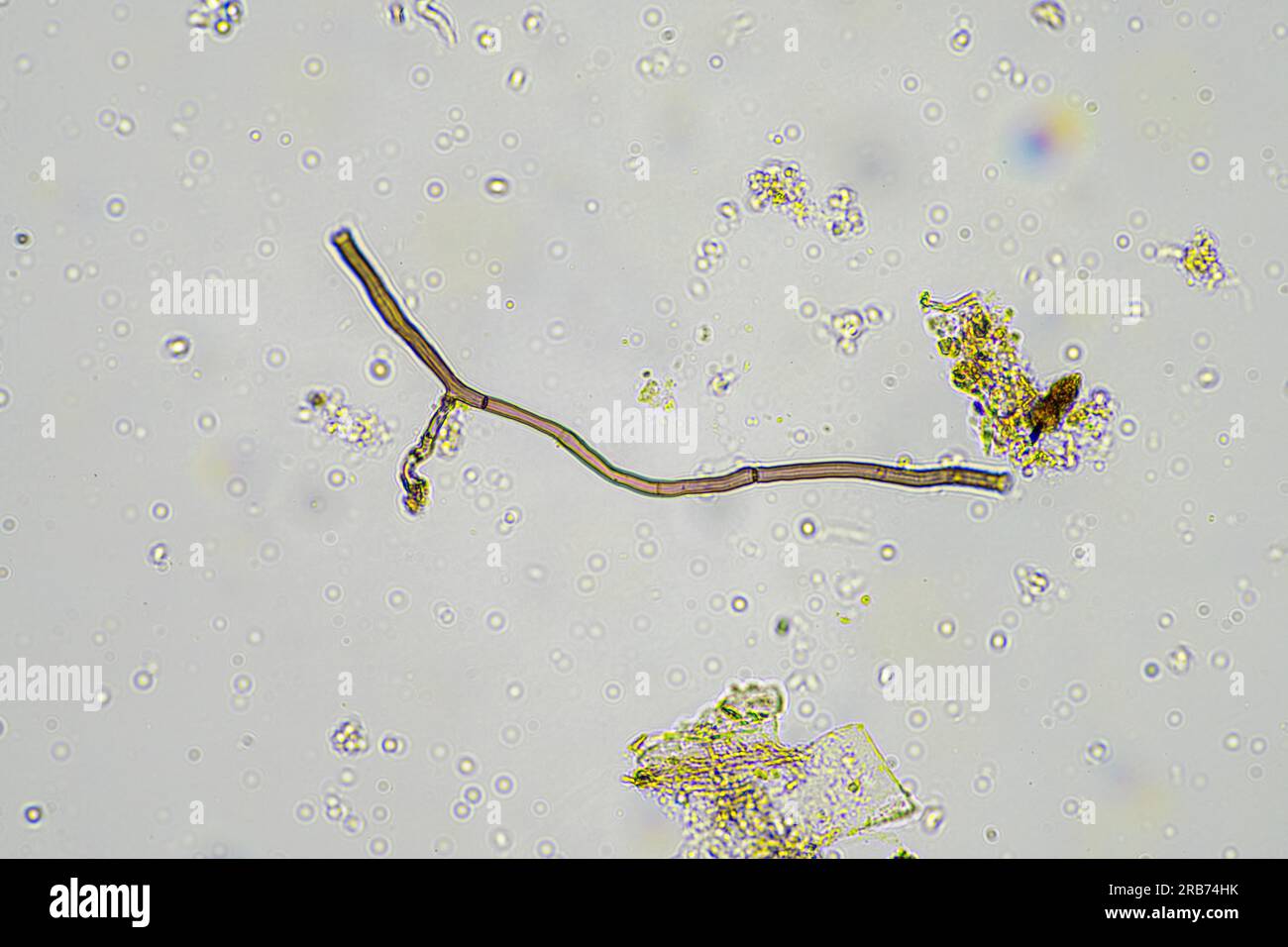 fungi hyphae in soil on a farm in australia Stock Photo - Alamy