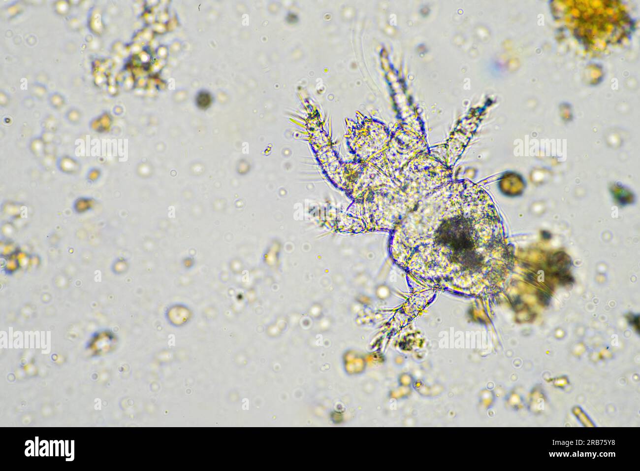 soil microbes organisms in a soil and compost sample, fungus and fungi ...