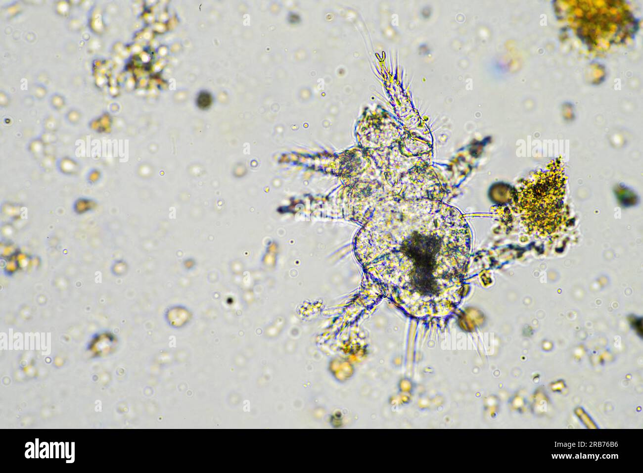 soil microbes organisms in a soil and compost sample, fungus and fungi ...