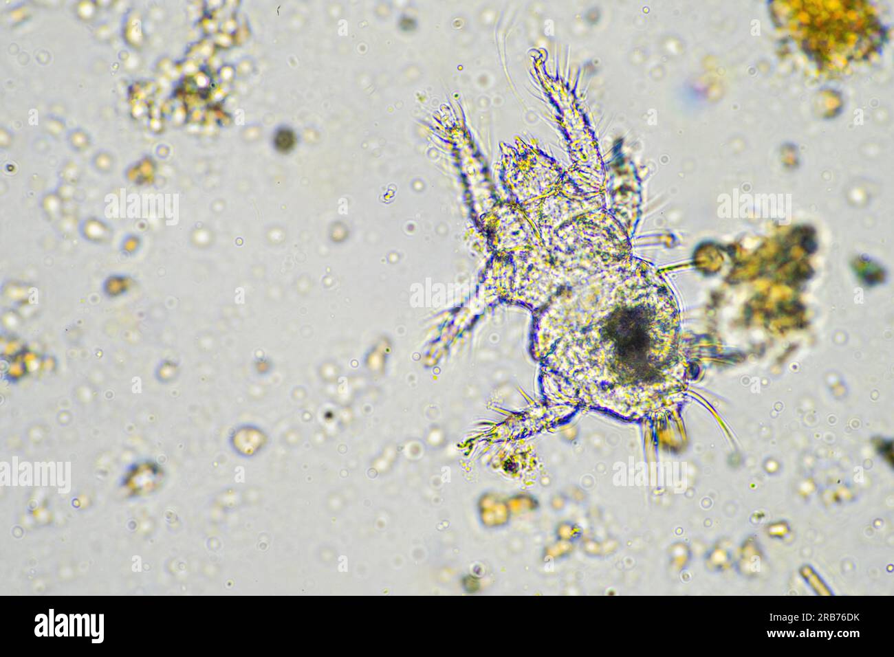 soil microbes organisms in a soil and compost sample, fungus and fungi ...