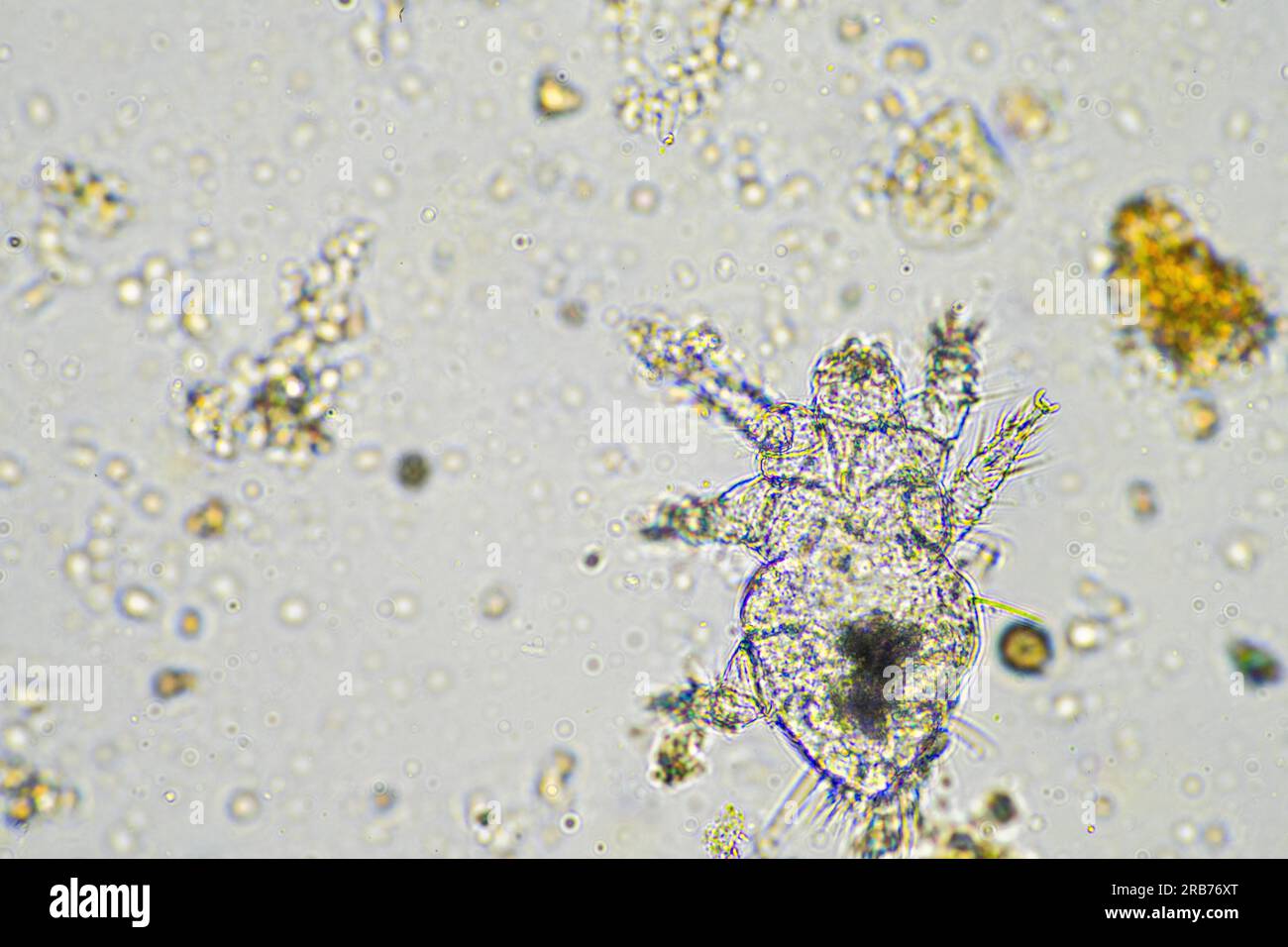 soil microbes organisms in a soil and compost sample, fungus and fungi ...