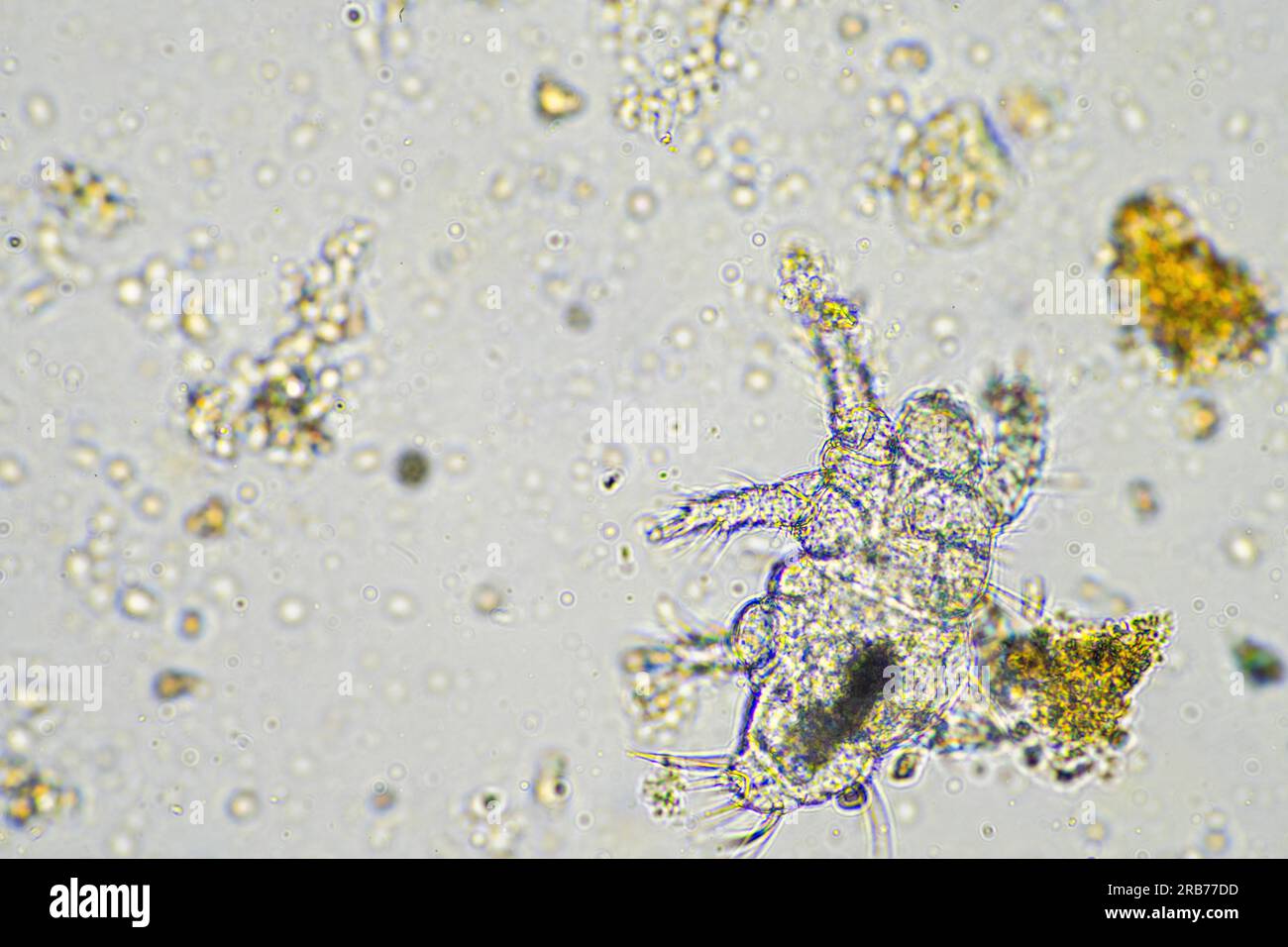 soil microbes organisms in a soil and compost sample, fungus and fungi ...