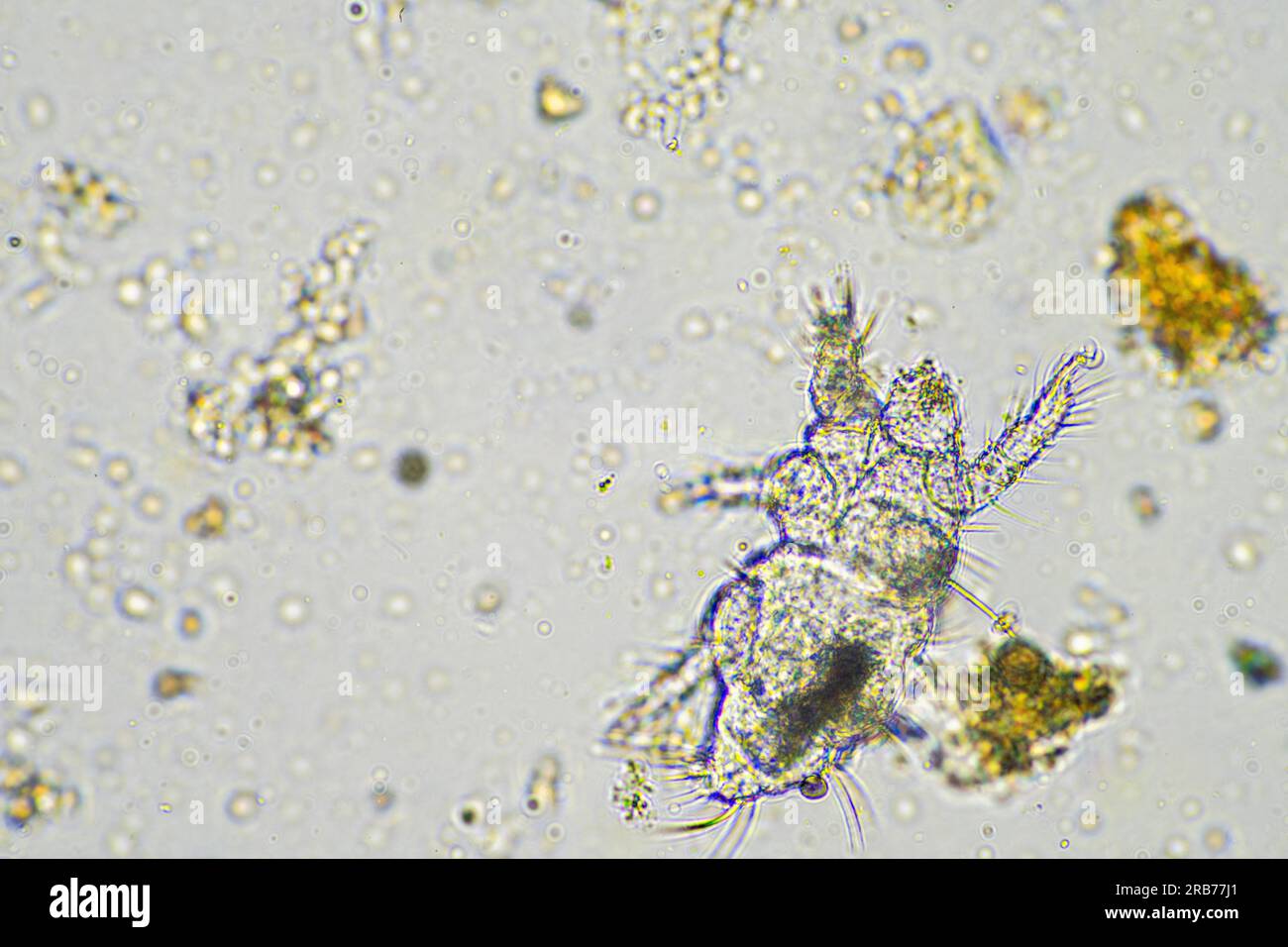 soil microbes organisms in a soil and compost sample, fungus and fungi ...