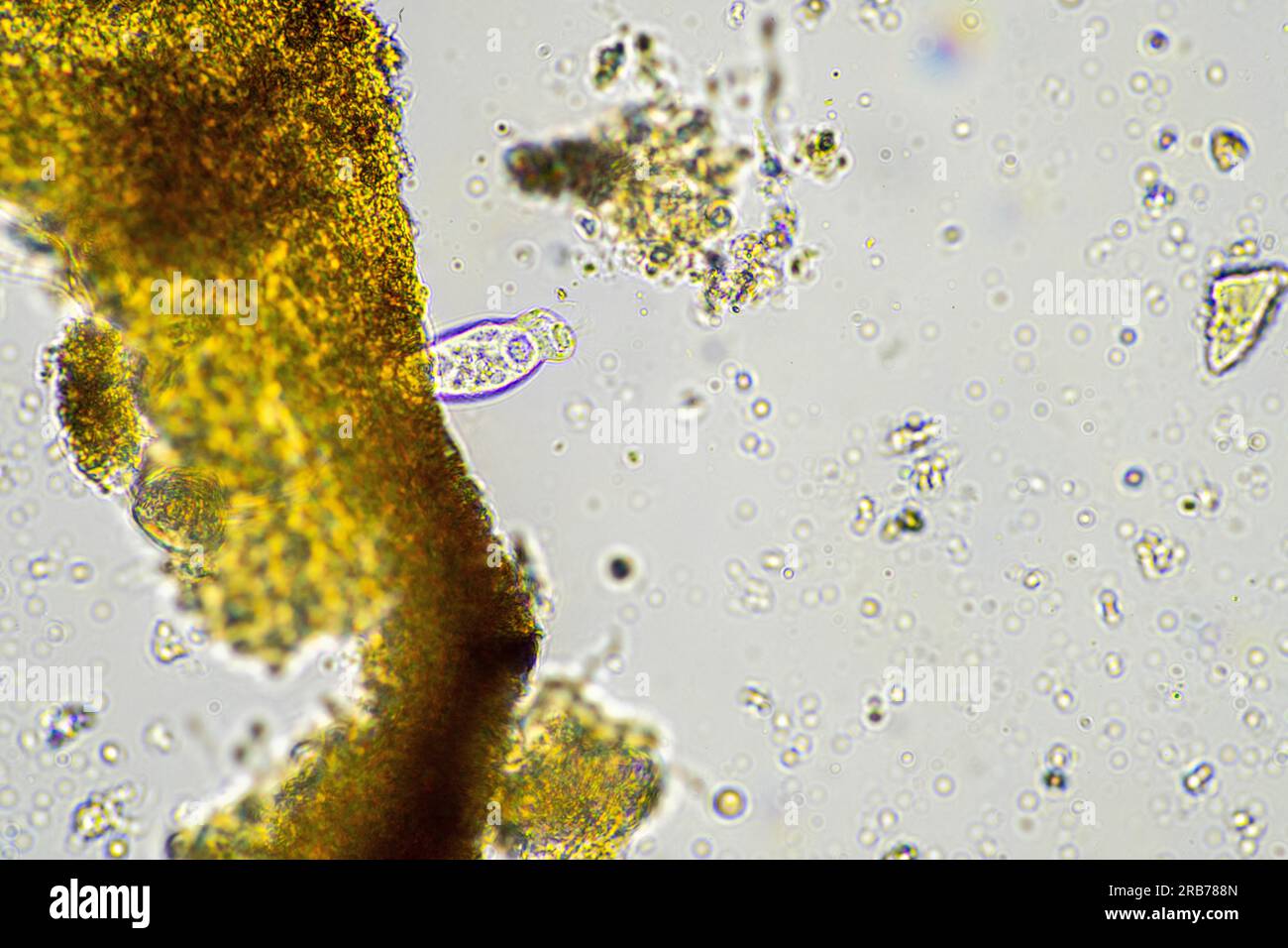 soil microbes organisms in a soil and compost sample, fungus and fungi ...
