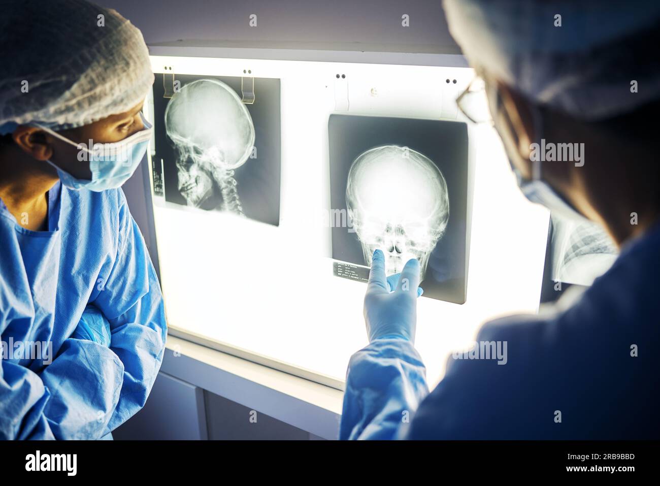 Skull x ray, screen and doctor with analysis of scan, healthcare and ...