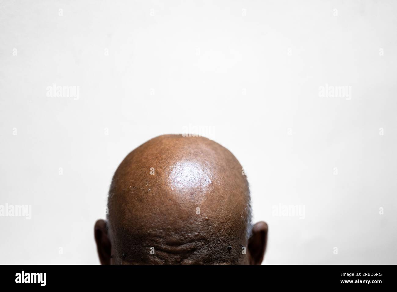 baldness, bald, head shot, close-up, portrait, man, male, adult, mature ...