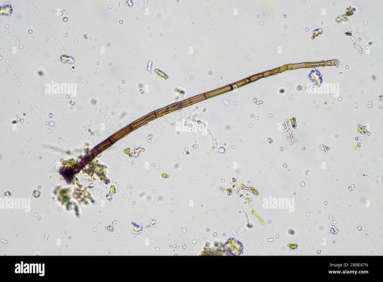 fungal hyphae under the microscope in a test Stock Photo - Alamy