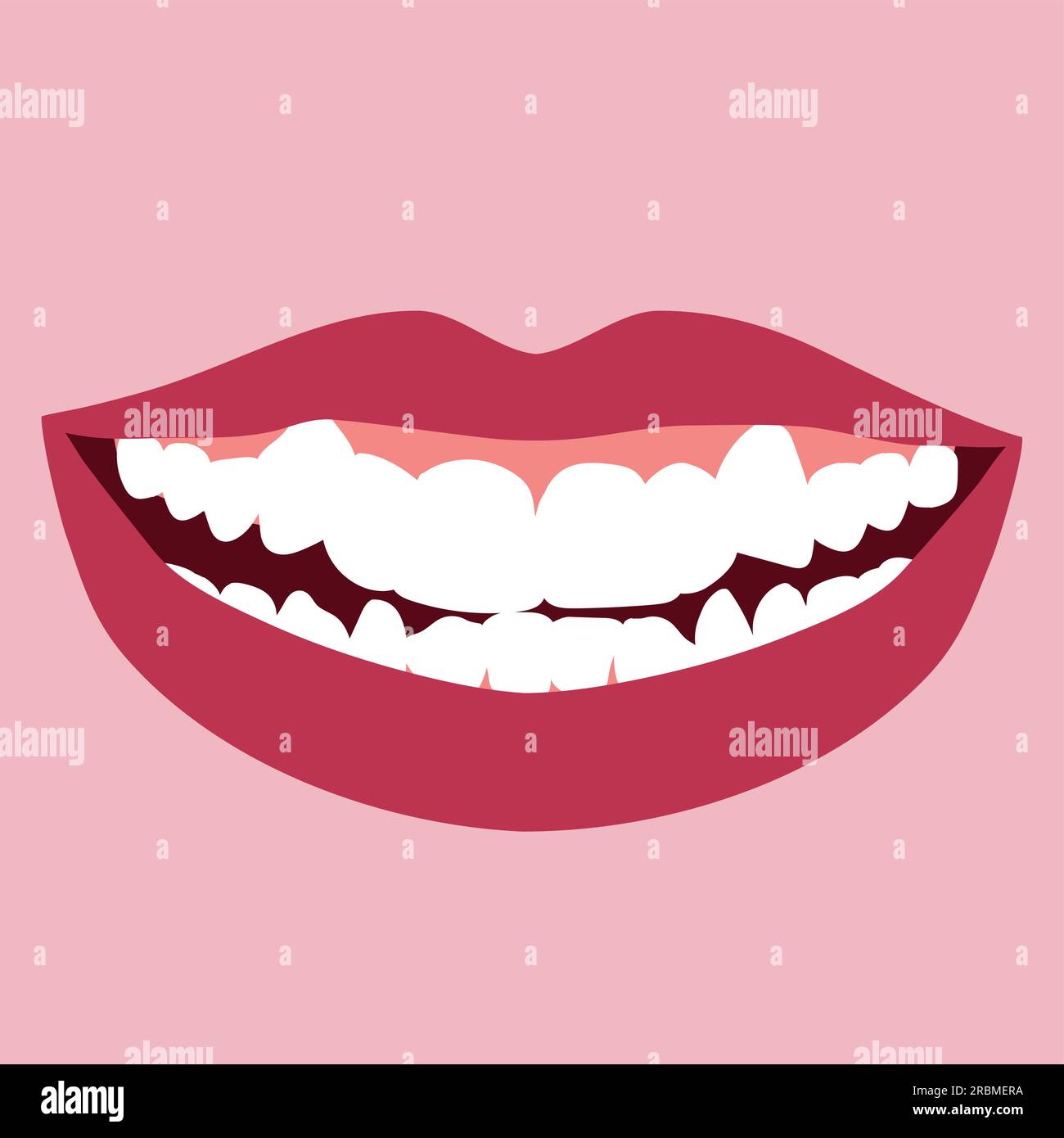 Crowded Teeth Problem