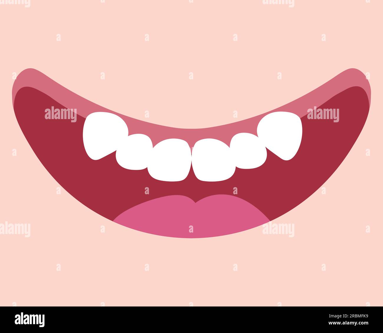 Cartoon smiling mouth with teeth crowding. Double tooth. Abnormal ...