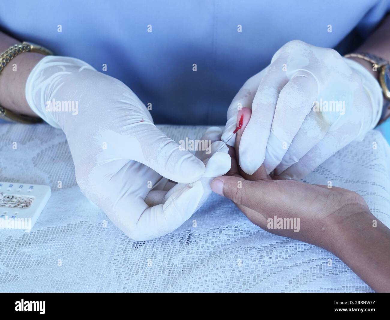 HCT , Hematocrit centrifuge plate with capillary tube , Hematocrit ...