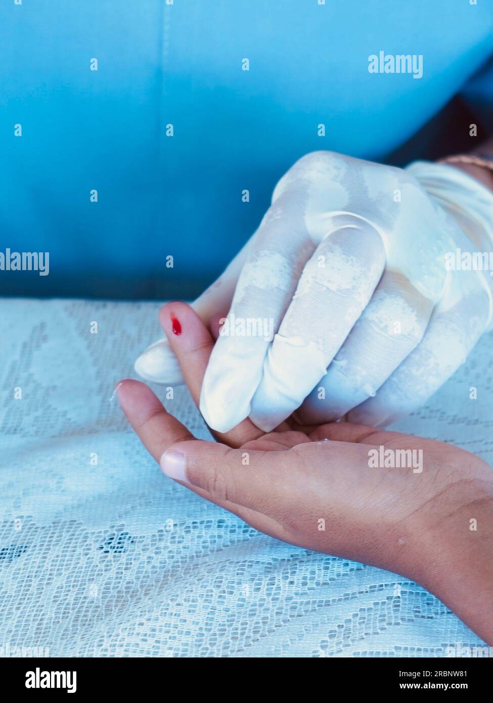 HCT , Hematocrit centrifuge plate with capillary tube , Hematocrit ...