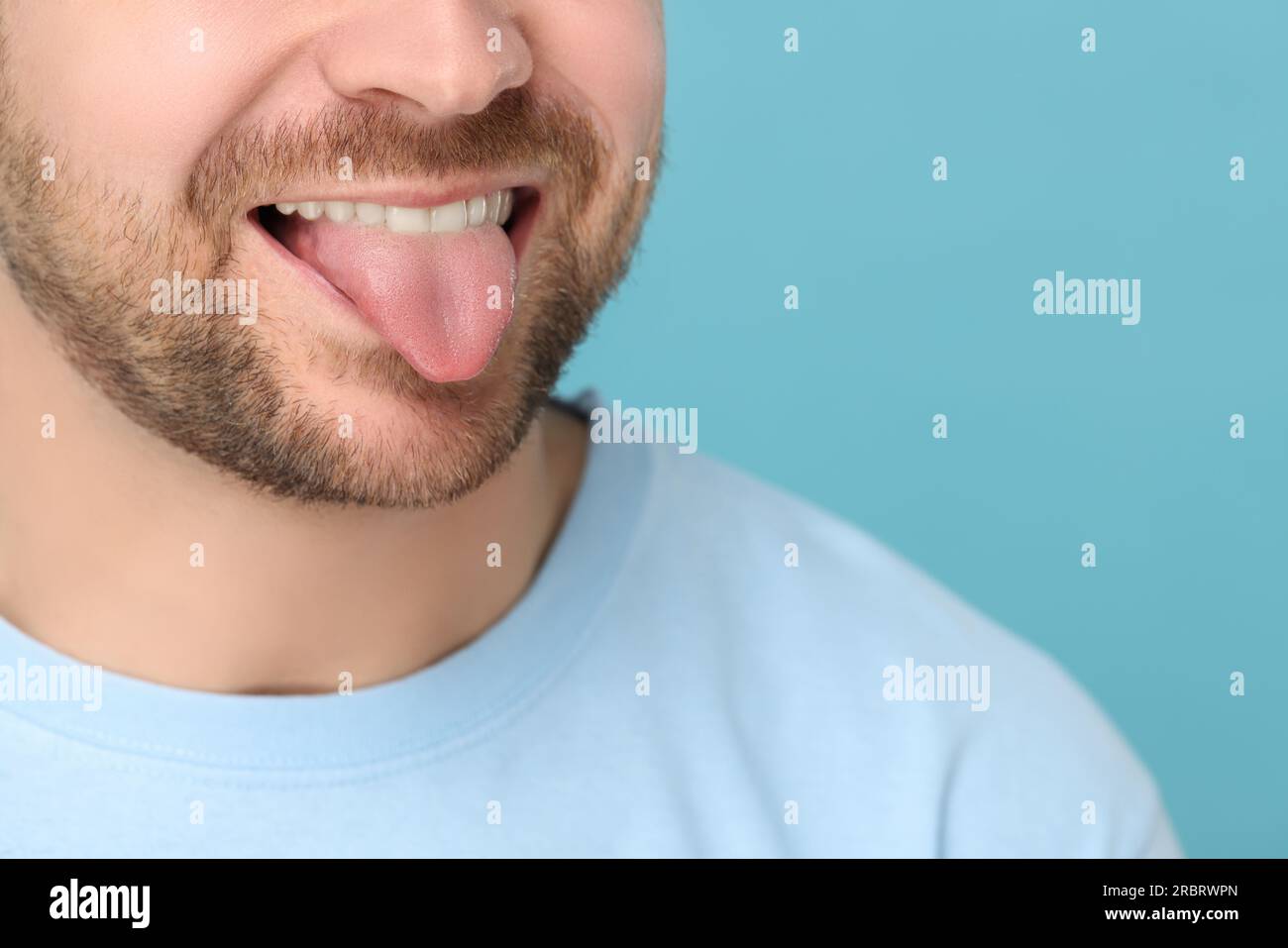 Blue tongue disease hi-res stock photography and images - Alamy
