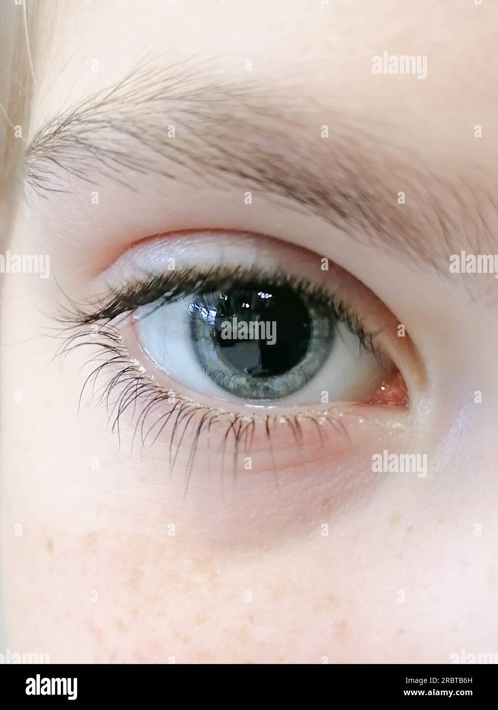 Pupils Dilated When High