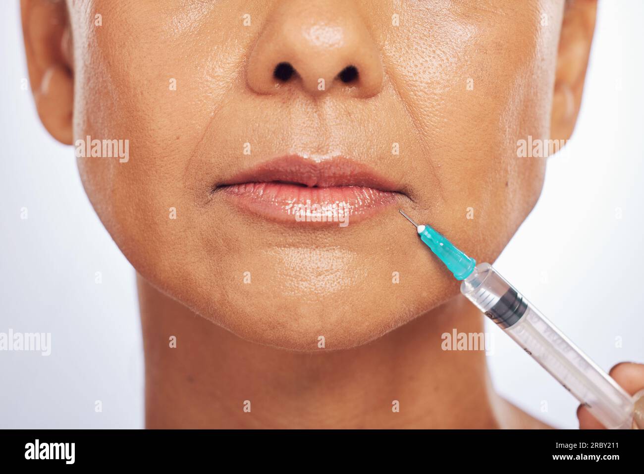 Lips, injection and face of woman for plastic surgery in studio, white ...