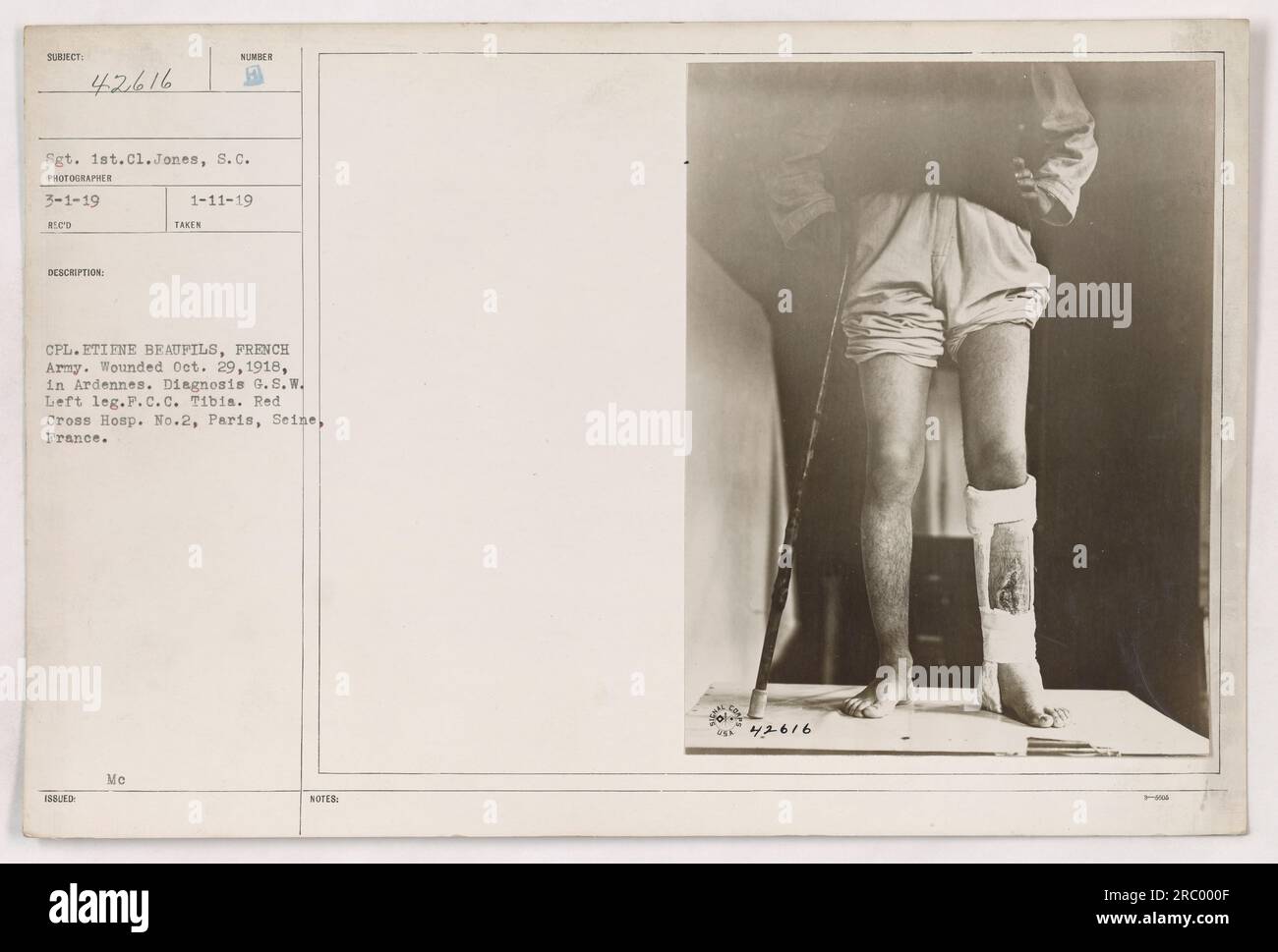 Gunshot wound leg hi-res stock photography and images - Alamy