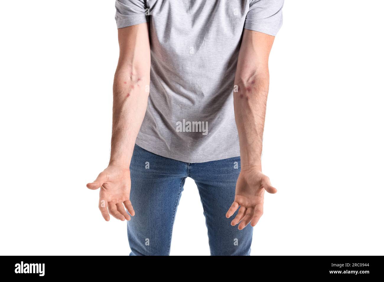Veins in the arms hi-res stock photography and images - Alamy