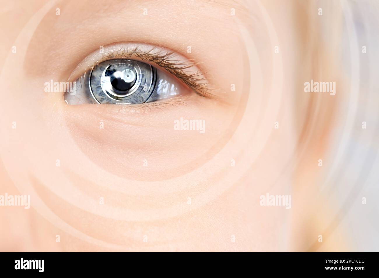 Hypnosis and therapy. Swirl over little child's face, closeup. Collage ...