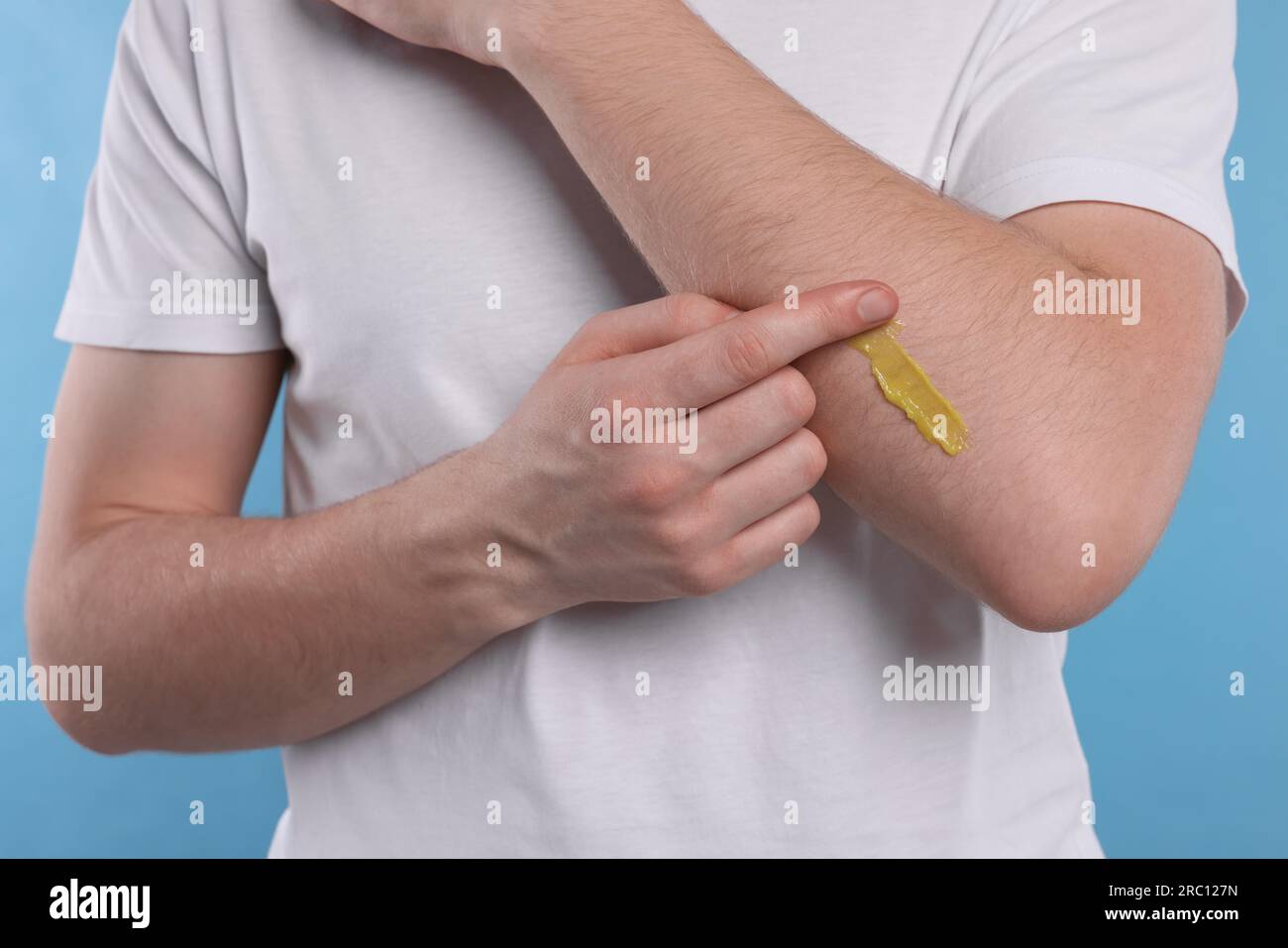 Man applying yellow ointment onto his arm on light blue background ...