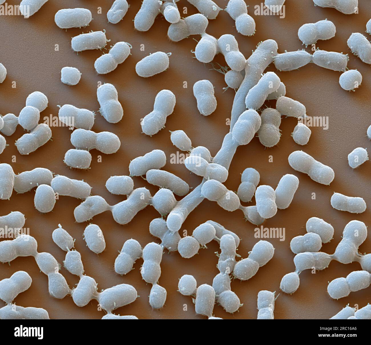Acinetobacter baumannii bacteria, SEM Stock Photo - Alamy Acinetobacter baumannii bacteria, SEM Stock Photo - Alamy