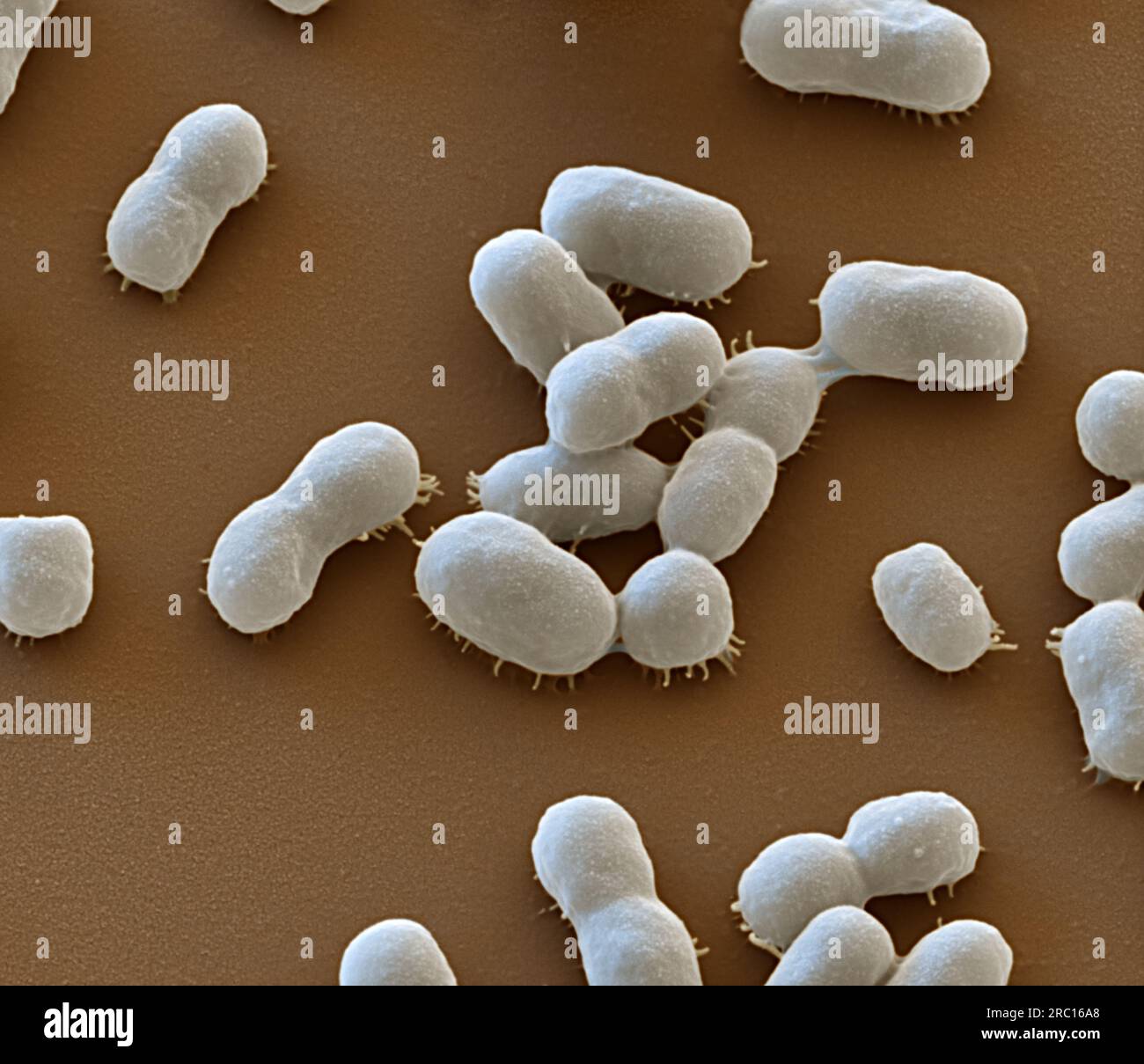 Acinetobacter baumannii bacteria, SEM Stock Photo - Alamy