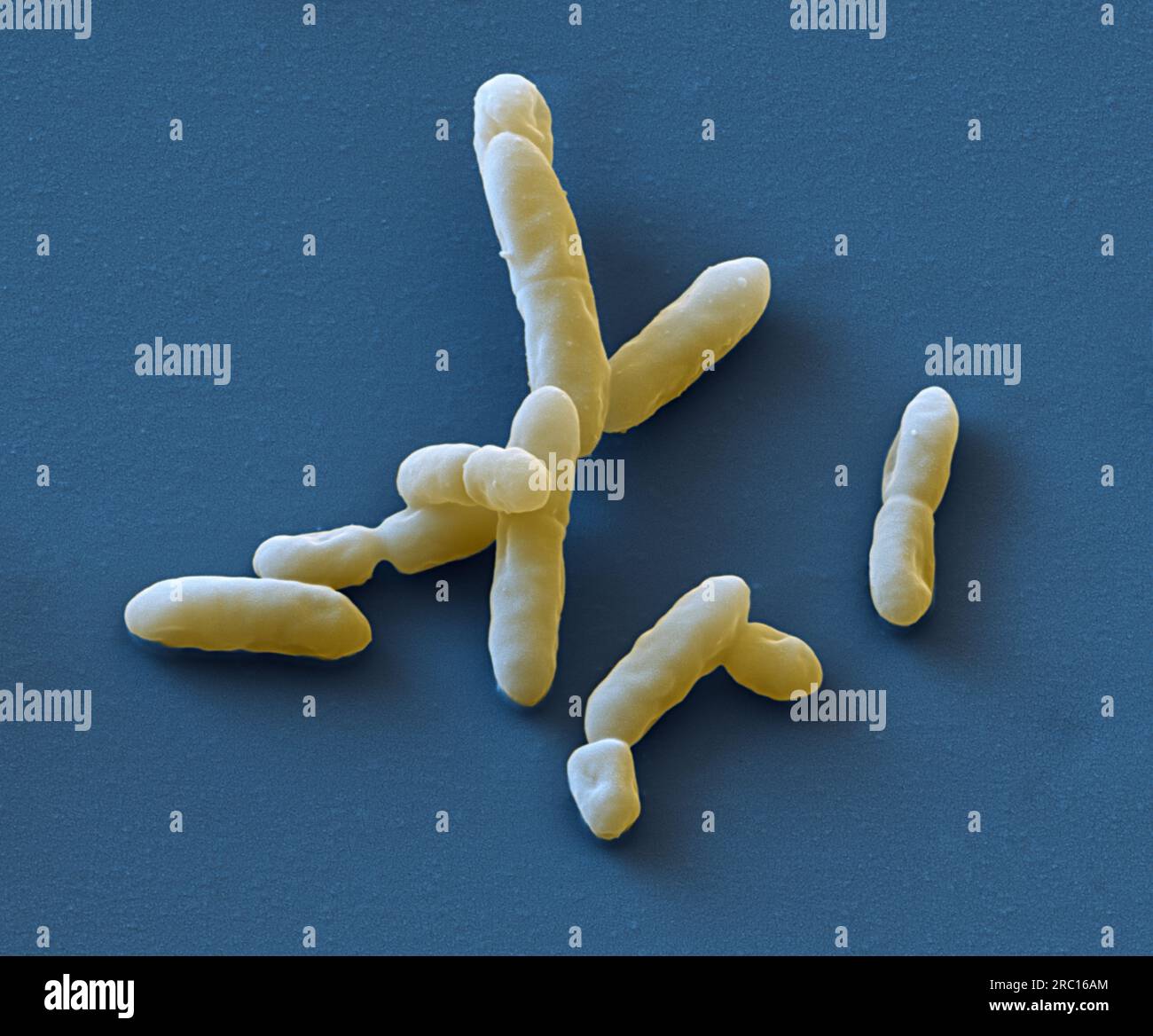 Cronobacter sakazakii bacteria, SEM Stock Photo - Alamy
