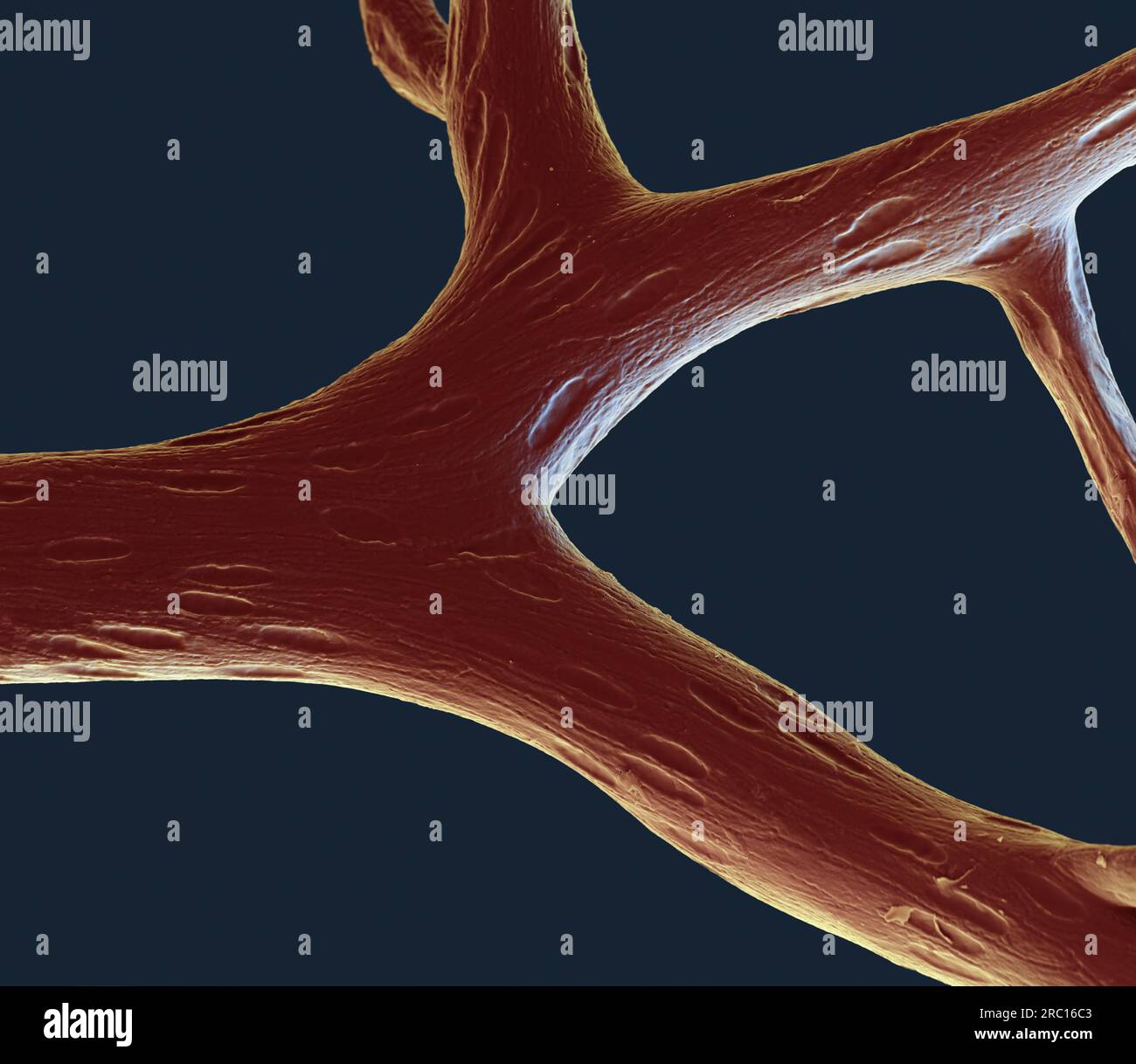 Capillary blood vessels, SEM Stock Photo - Alamy