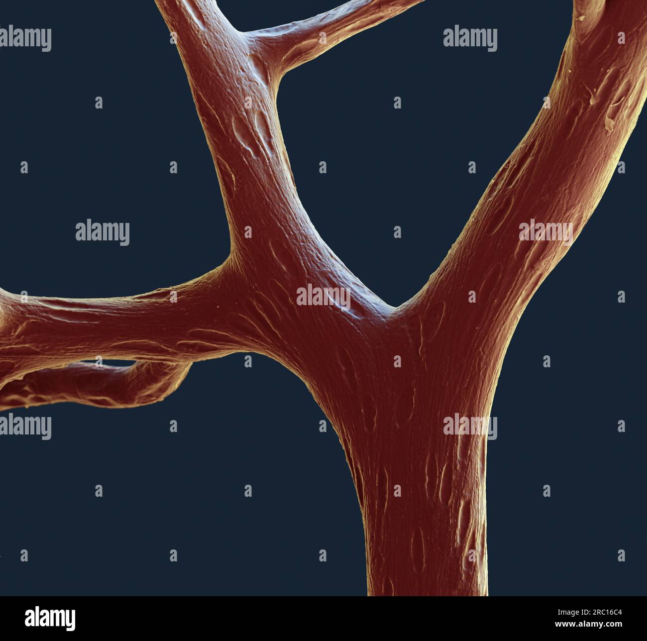 Capillary blood vessels, SEM Stock Photo - Alamy