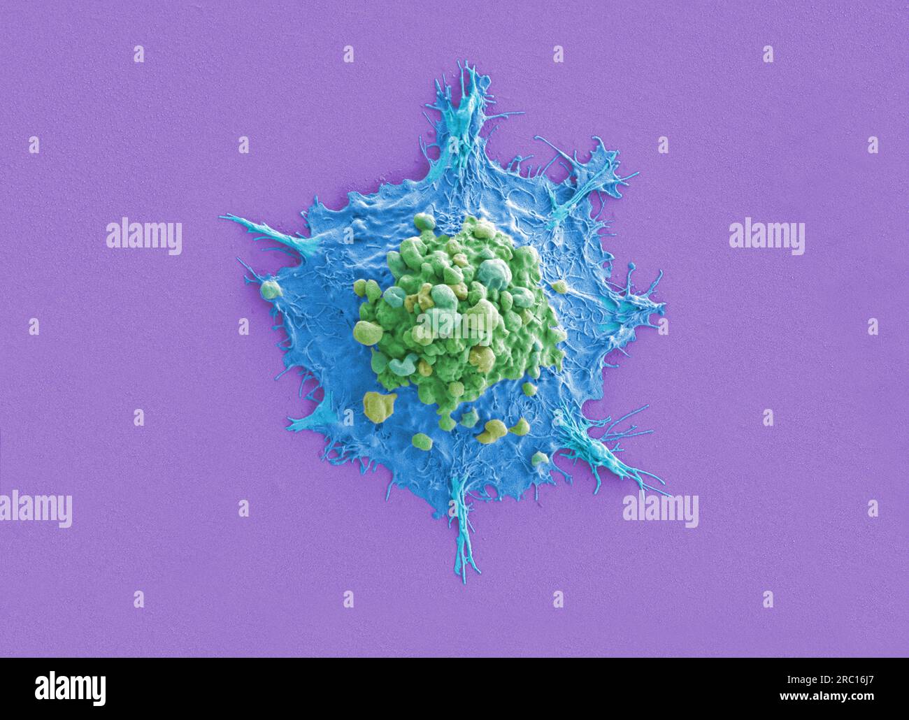 Lung cancer cell, SEM Stock Photo - Alamy