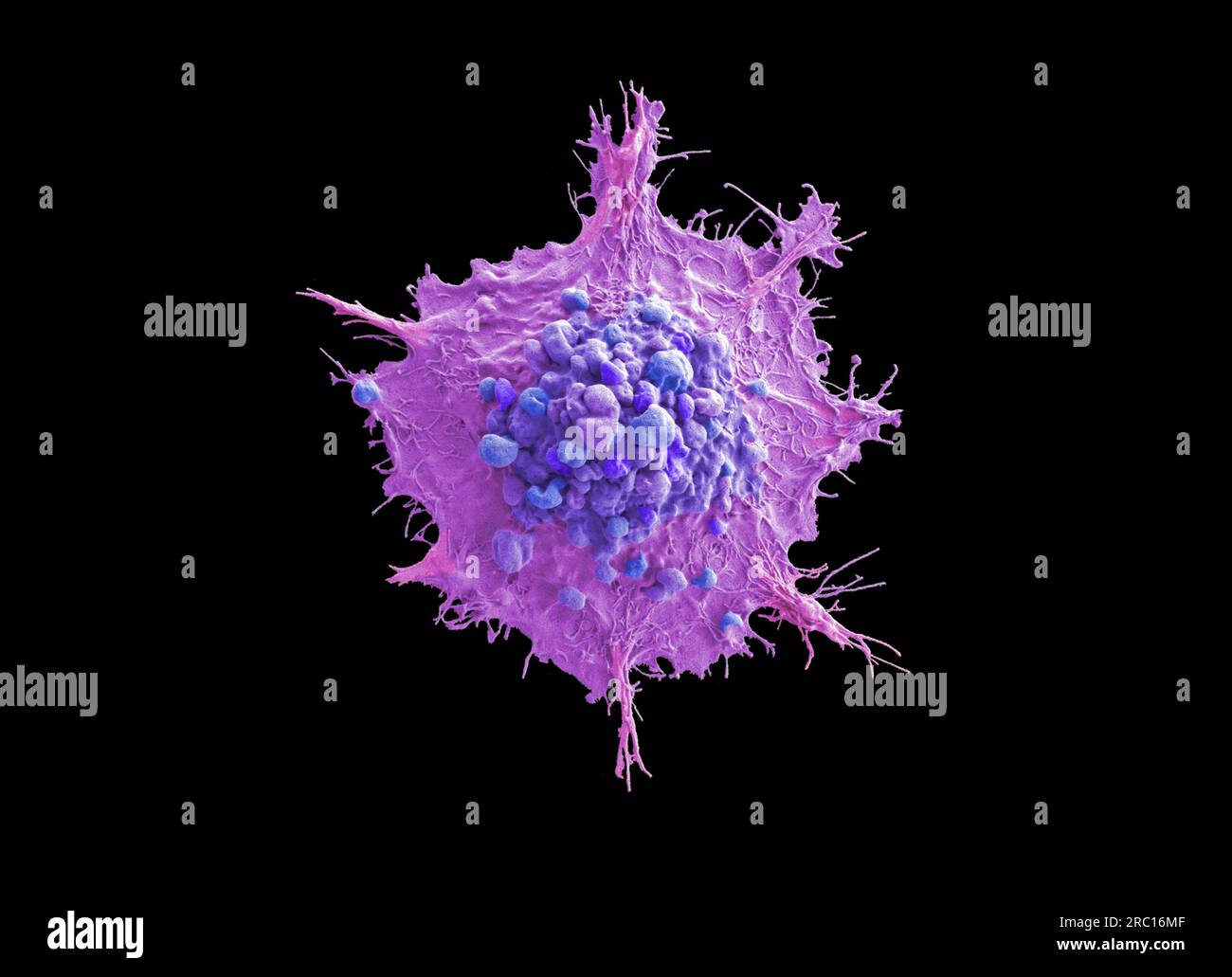 Lung cancer cell, SEM Stock Photo - Alamy