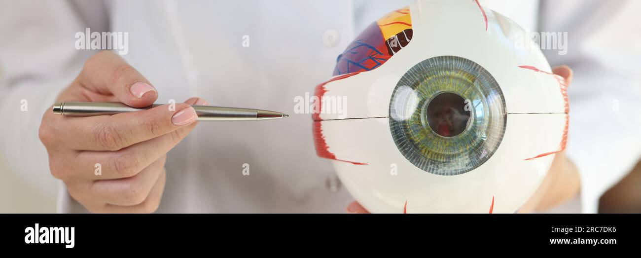 Ophthalmologist doctor holds part of anatomical model of eye close up ...