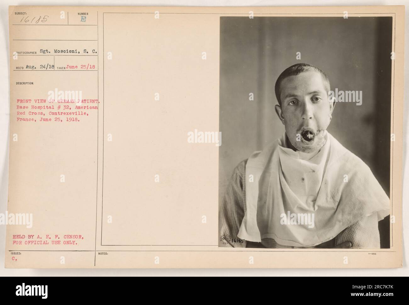 World war 1 medical facilities hi-res stock photography and images - Alamy