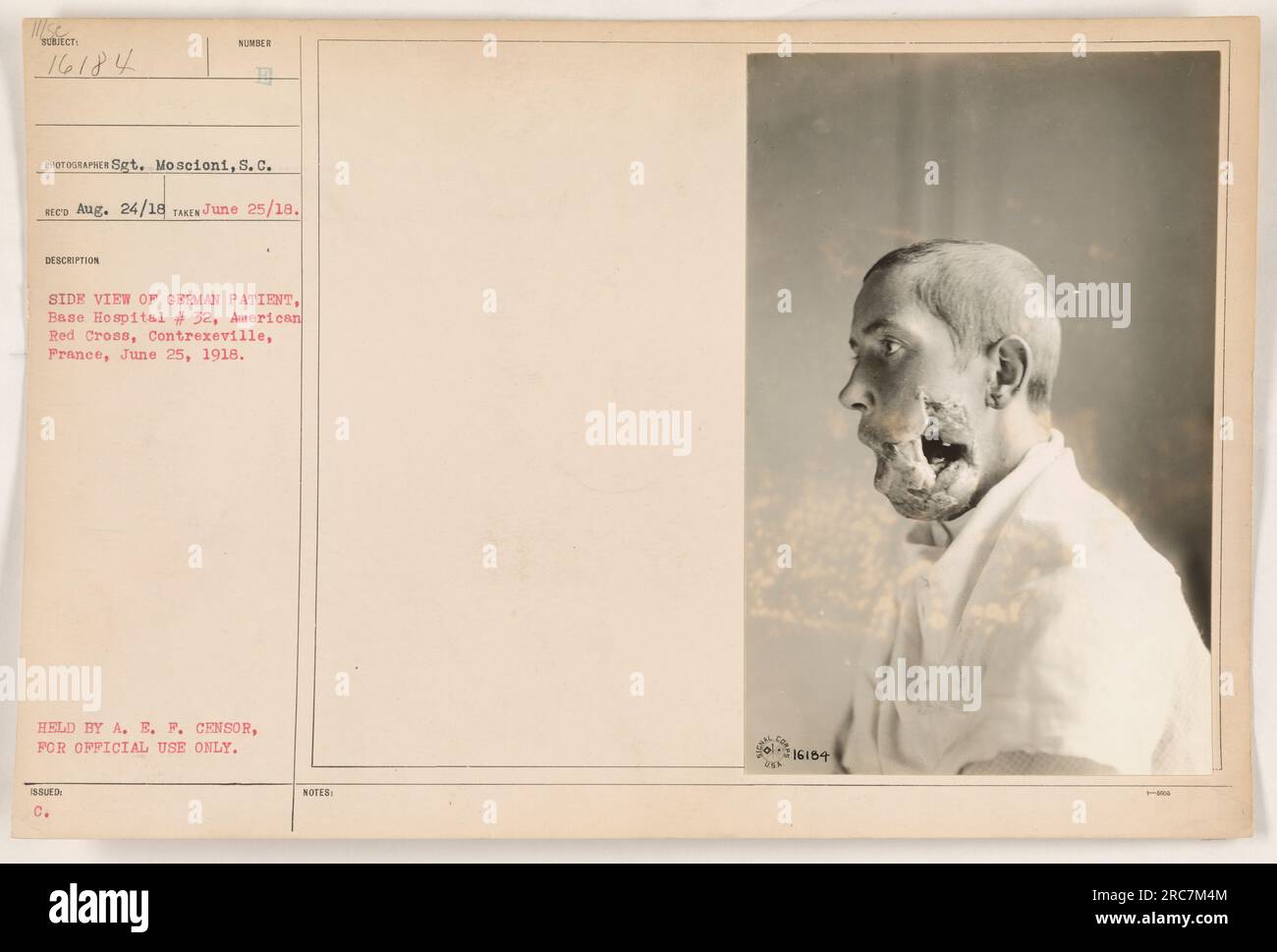 German patient receiving medical care at Base Hospital #32 in ...