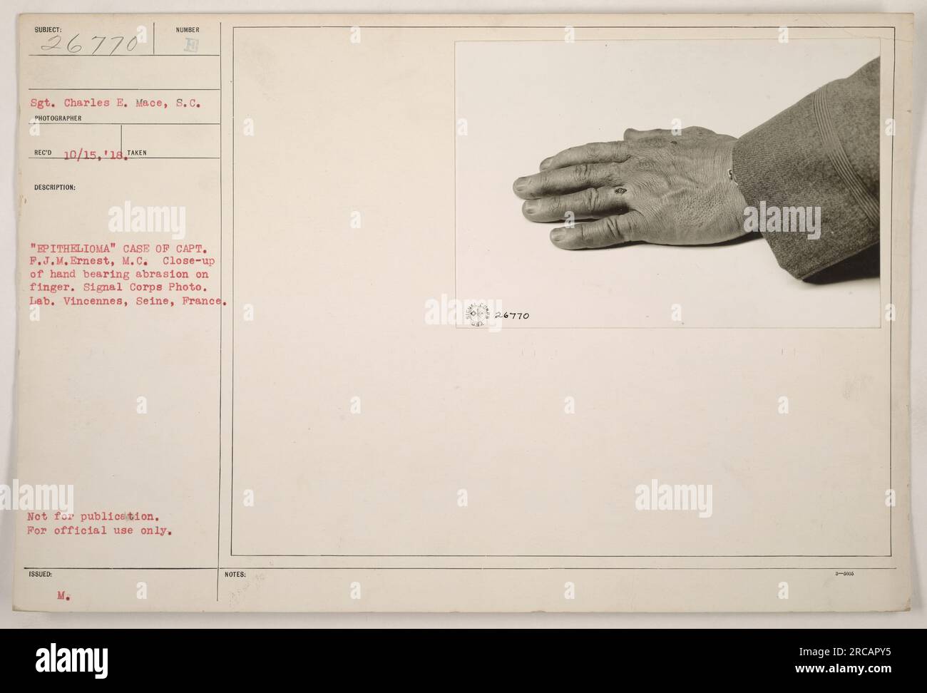 Close-up photograph showing the hand of Sgt. Charles E. Mace from the ...