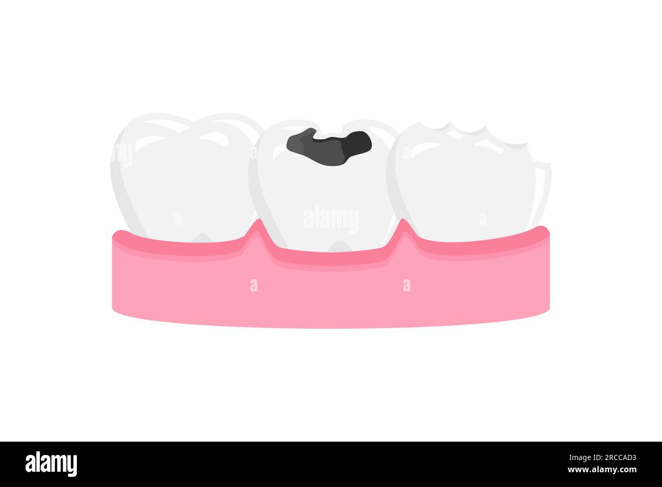 cavity teeth vector illustration. toothache icon sign symbol Stock ...