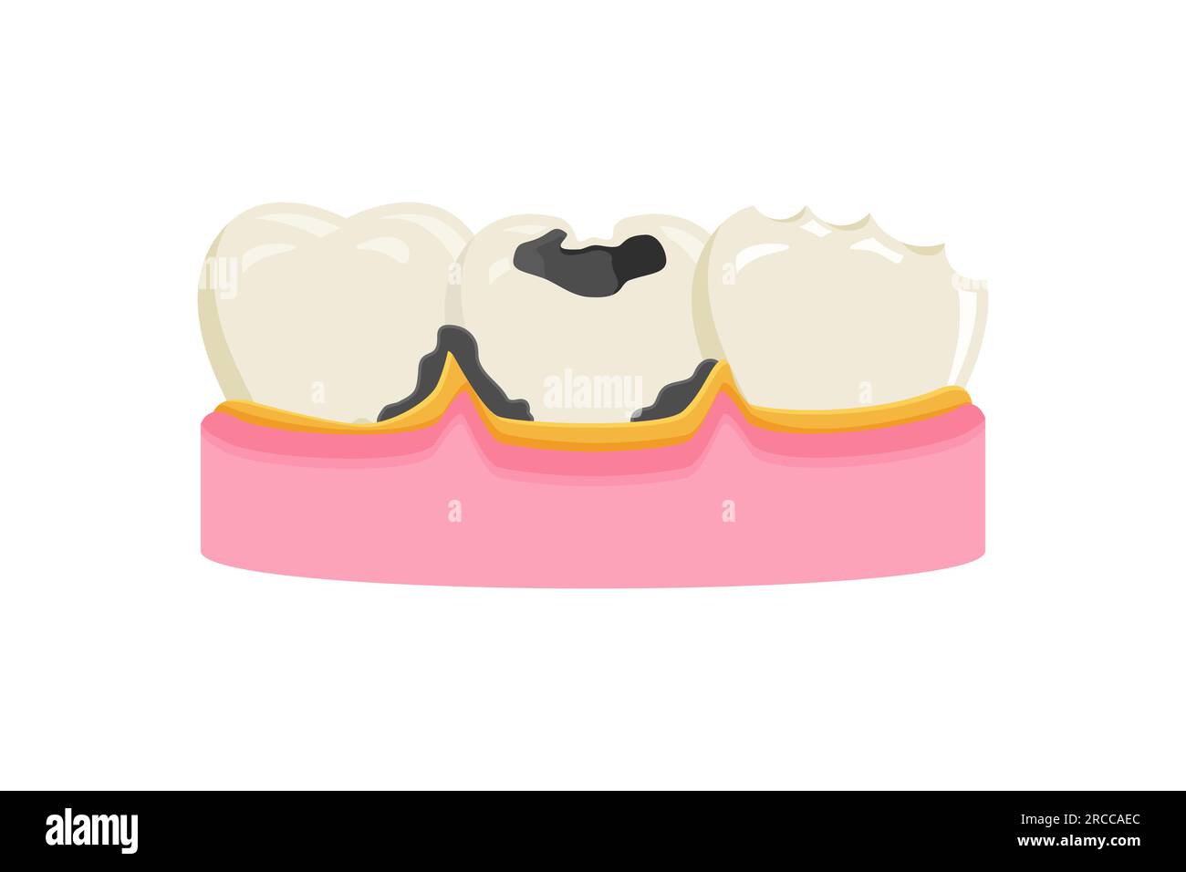 cavity teeth vector illustration. toothache icon sign symbol Stock ...