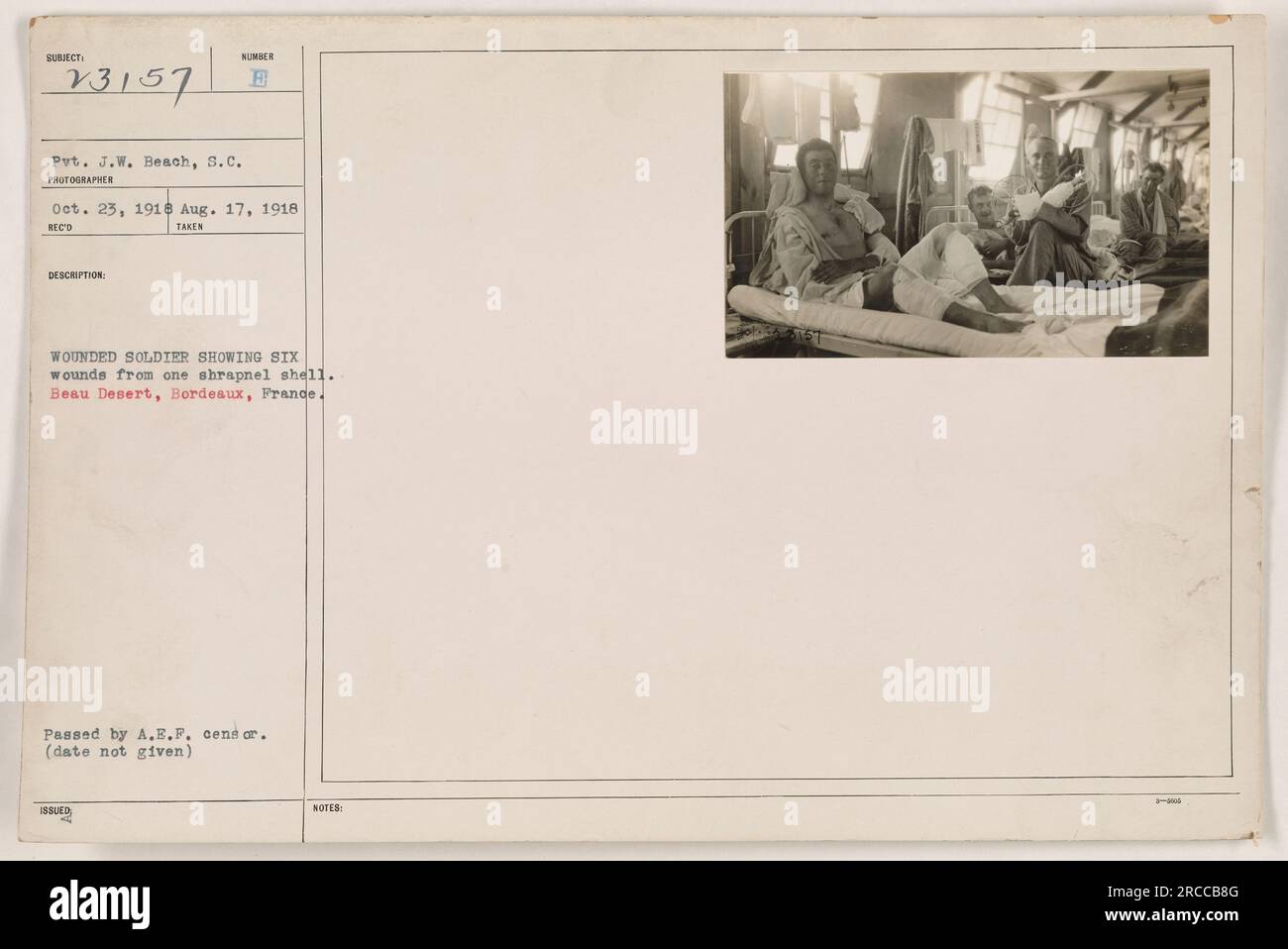 Wounded soldier Pvt. J.W. Beach displaying six wounds caused by a ...