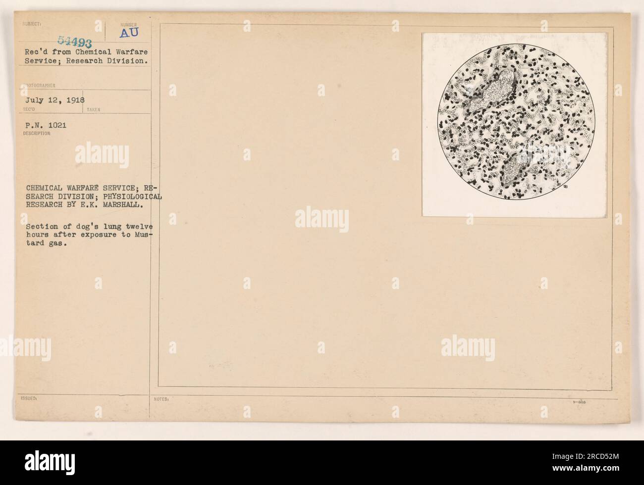 Section of dog's lung twelve hours after exposure to Mustard gas. This ...