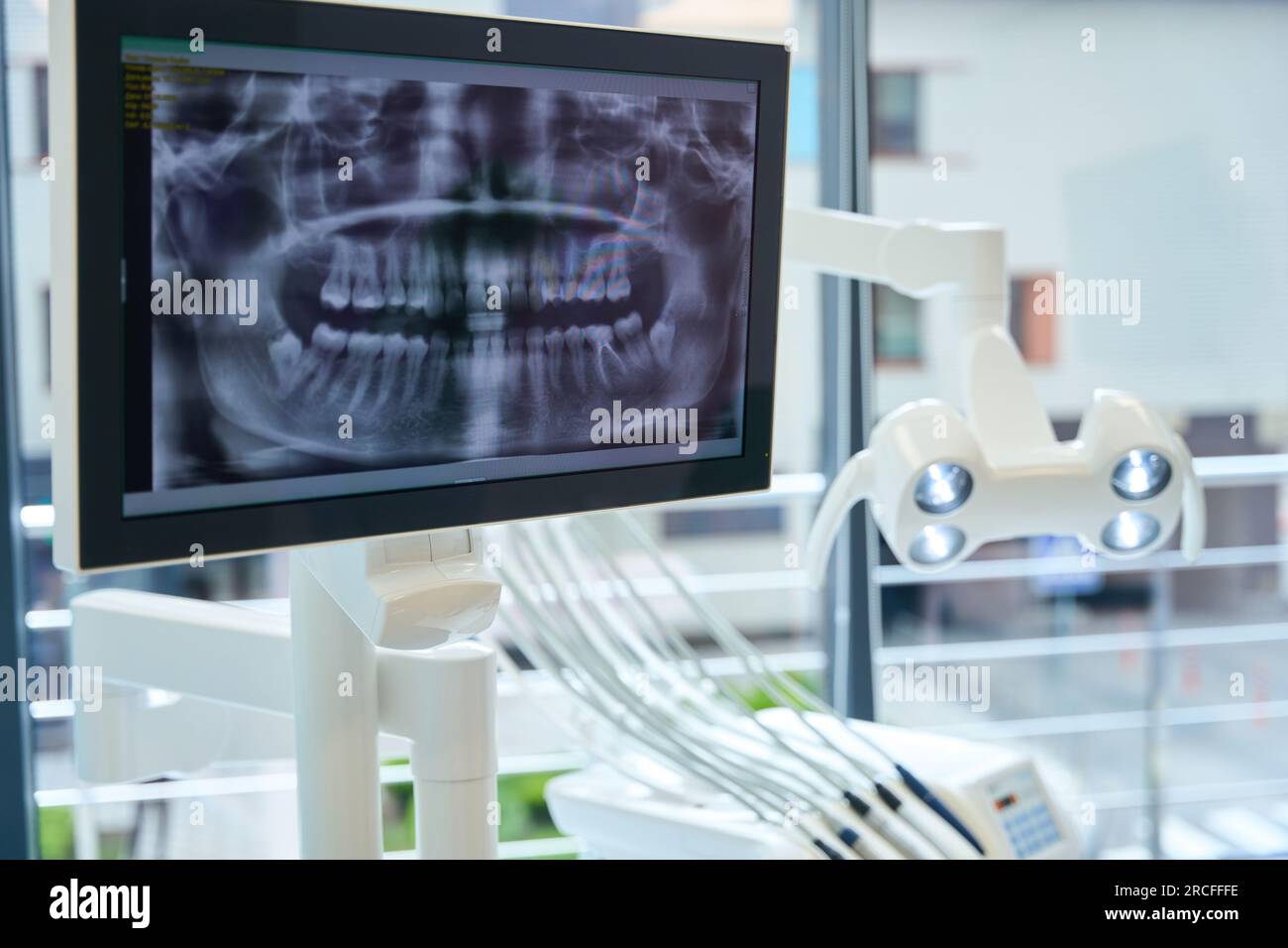 Monitor with the image of a dental x-ray Stock Photo - Alamy